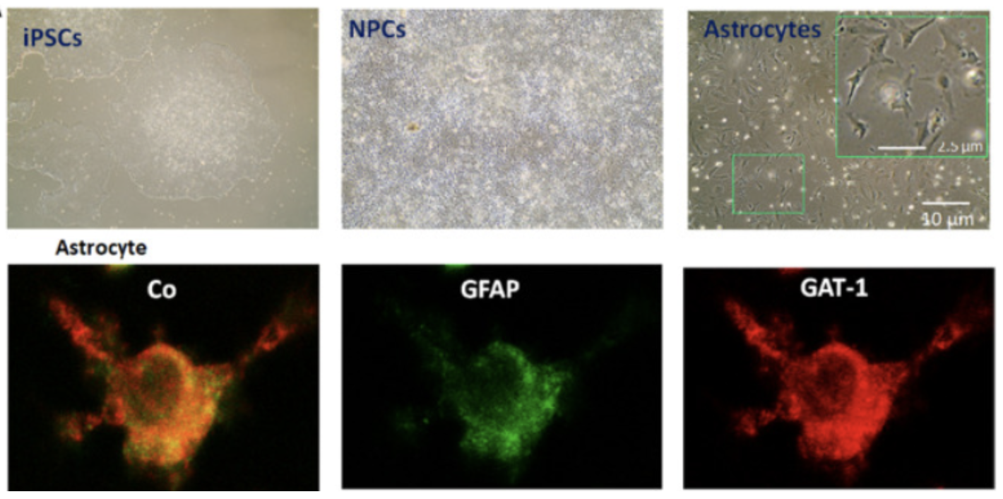 Understanding SLC6A1 Disorders: How iPSCs Are Helping Us Find New ...